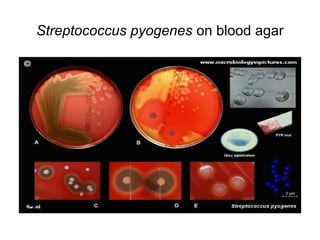 Staphylococci And Streptococci