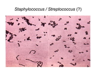 Streptobacillus Gram Positive
