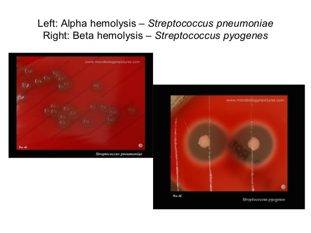 Streptococcus Pneumoniae Colony Morphology