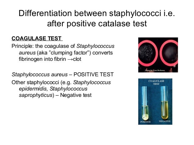 Staphylococcus streptococcus bacteriological diagnosis_ii