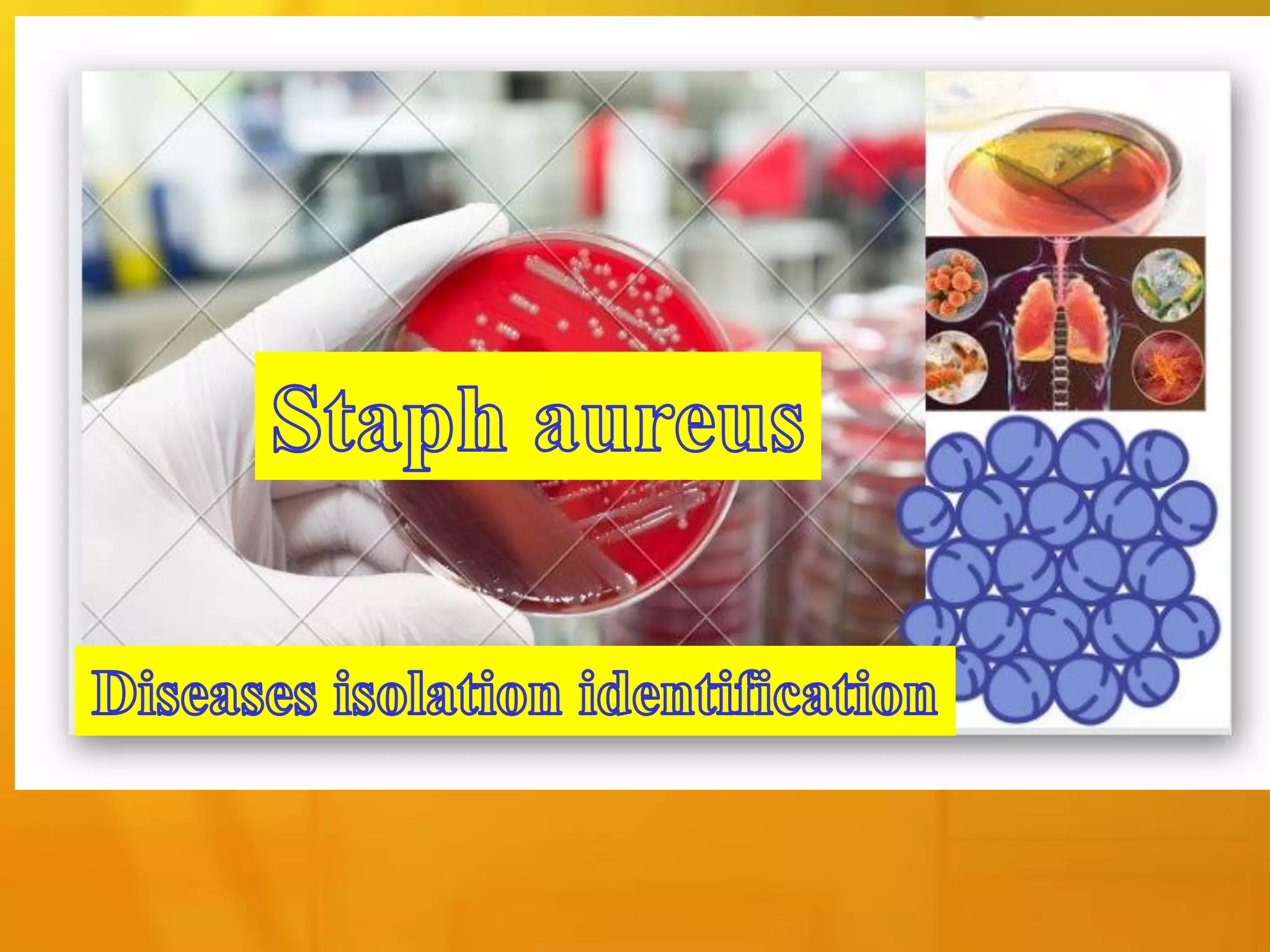 staphyococus aureus.pdf