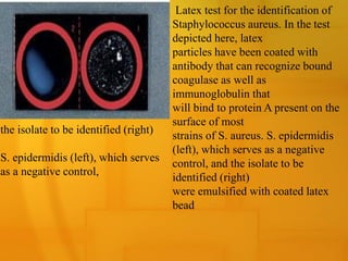 staphyococus aureus.pdf