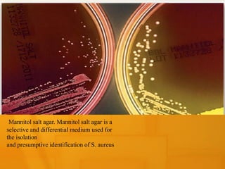 staphyococus aureus.pdf