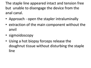 stapler misfire.pptx