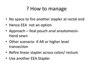 stapler misfire.pptx