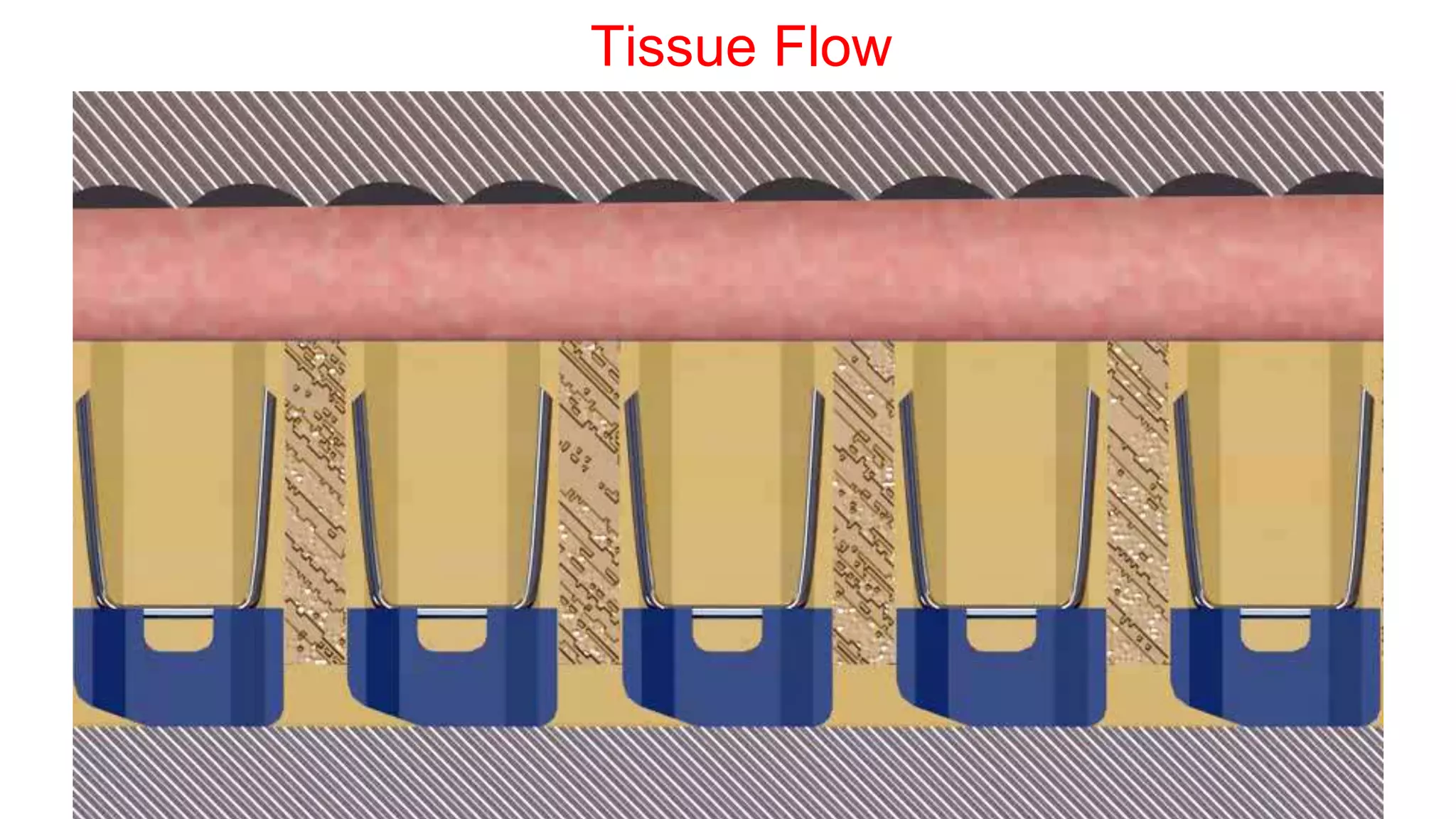 Staplers in Surgery | PPTX