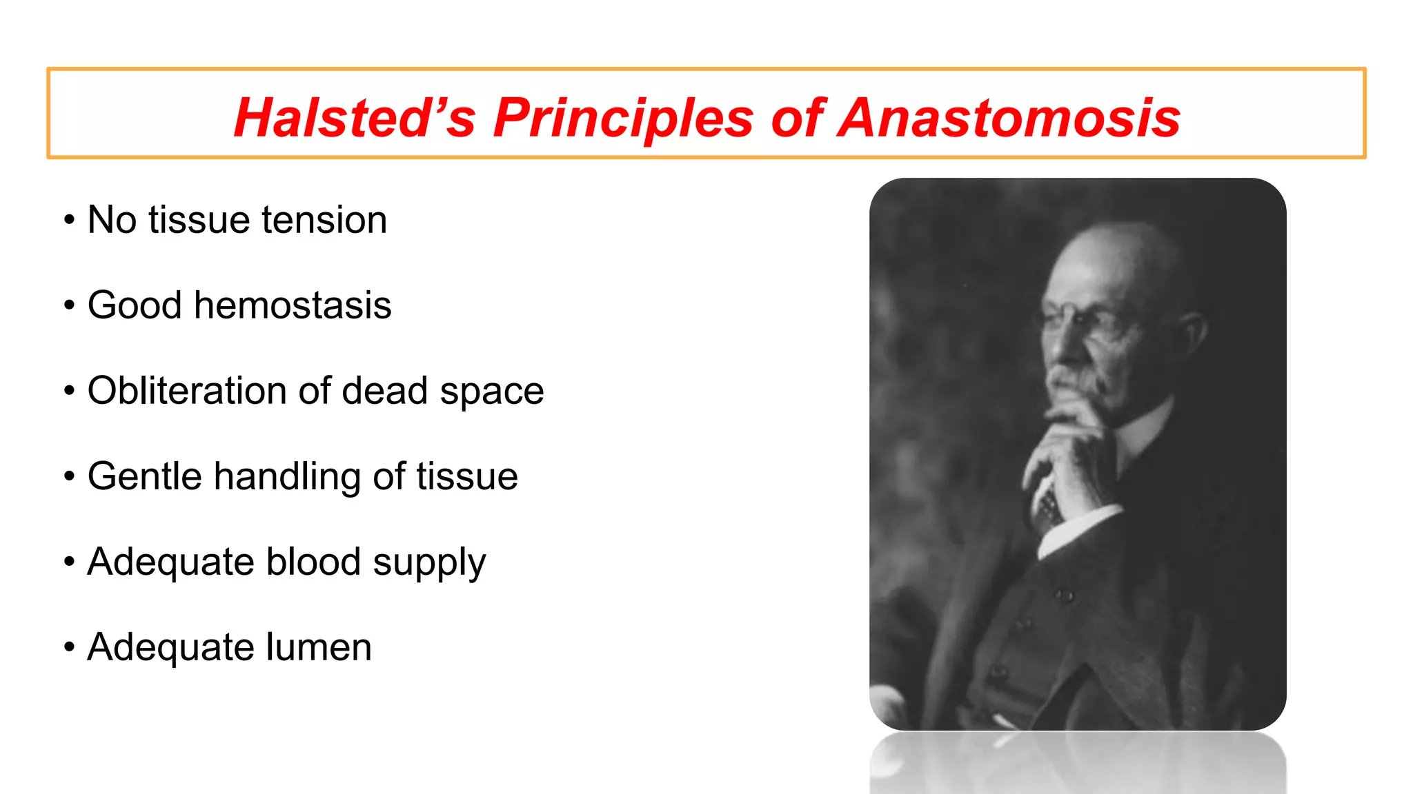 Staplers in Surgery | PPTX