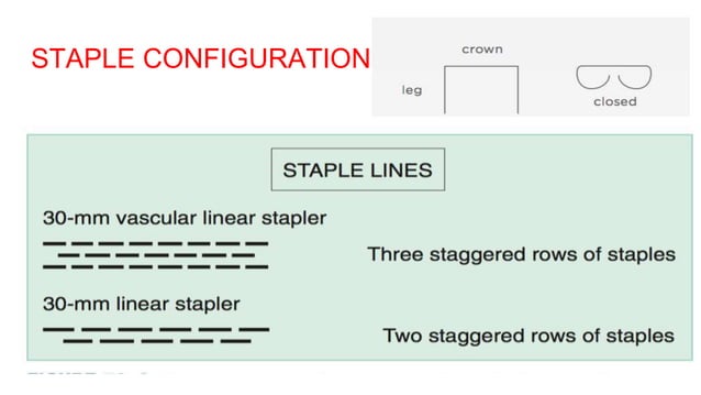 Staplers in Surgery | PPTX