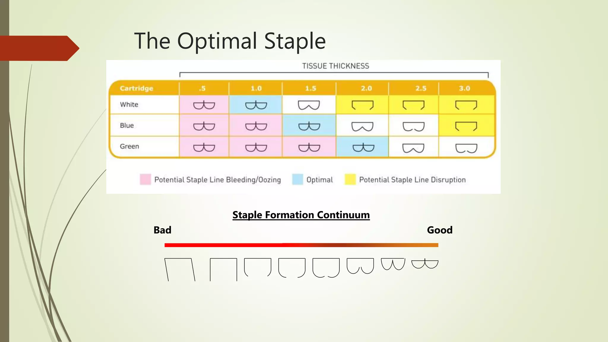 Use of Staplers in surgery | PPTX