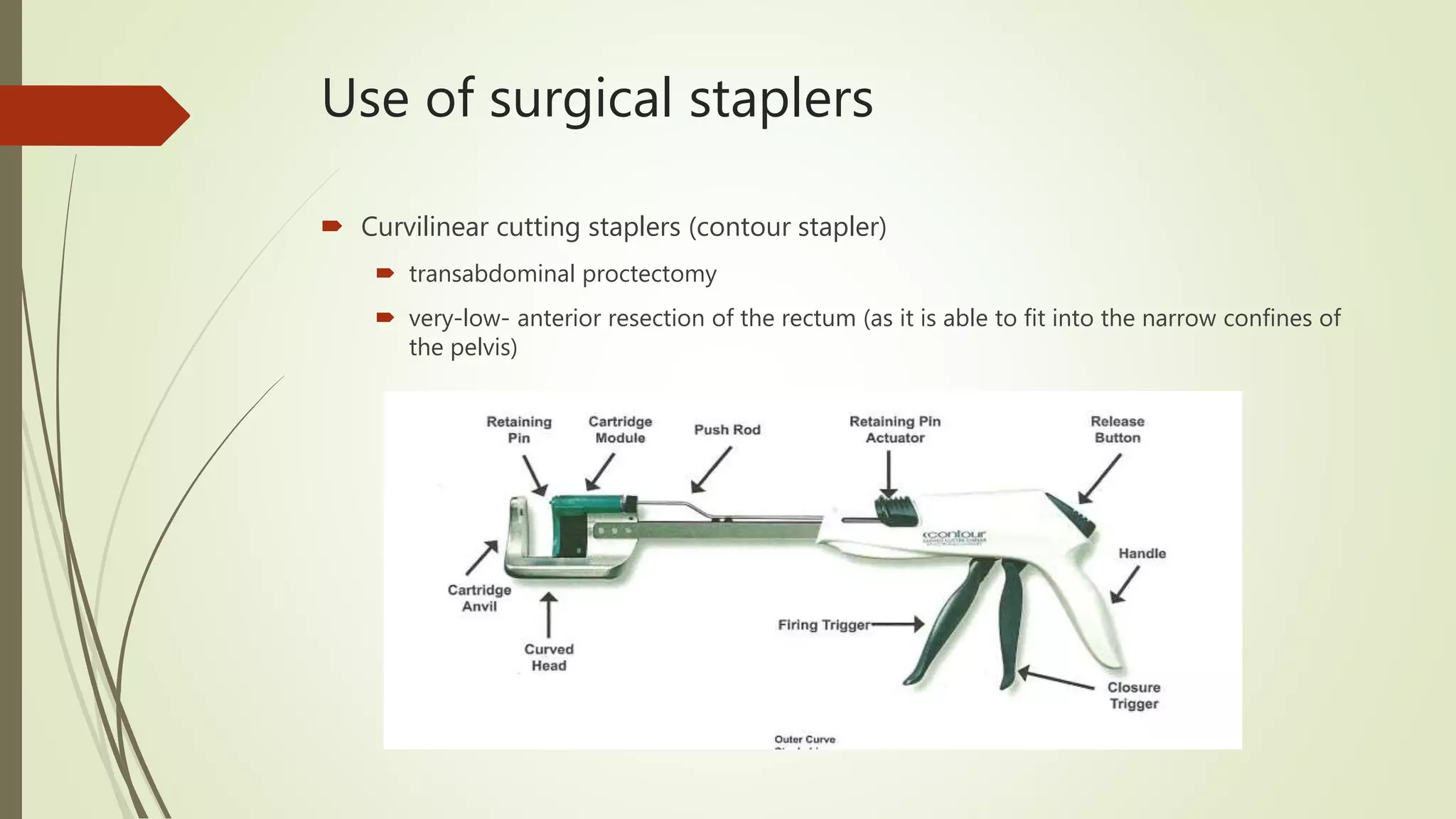 Use of Staplers in surgery | PPTX