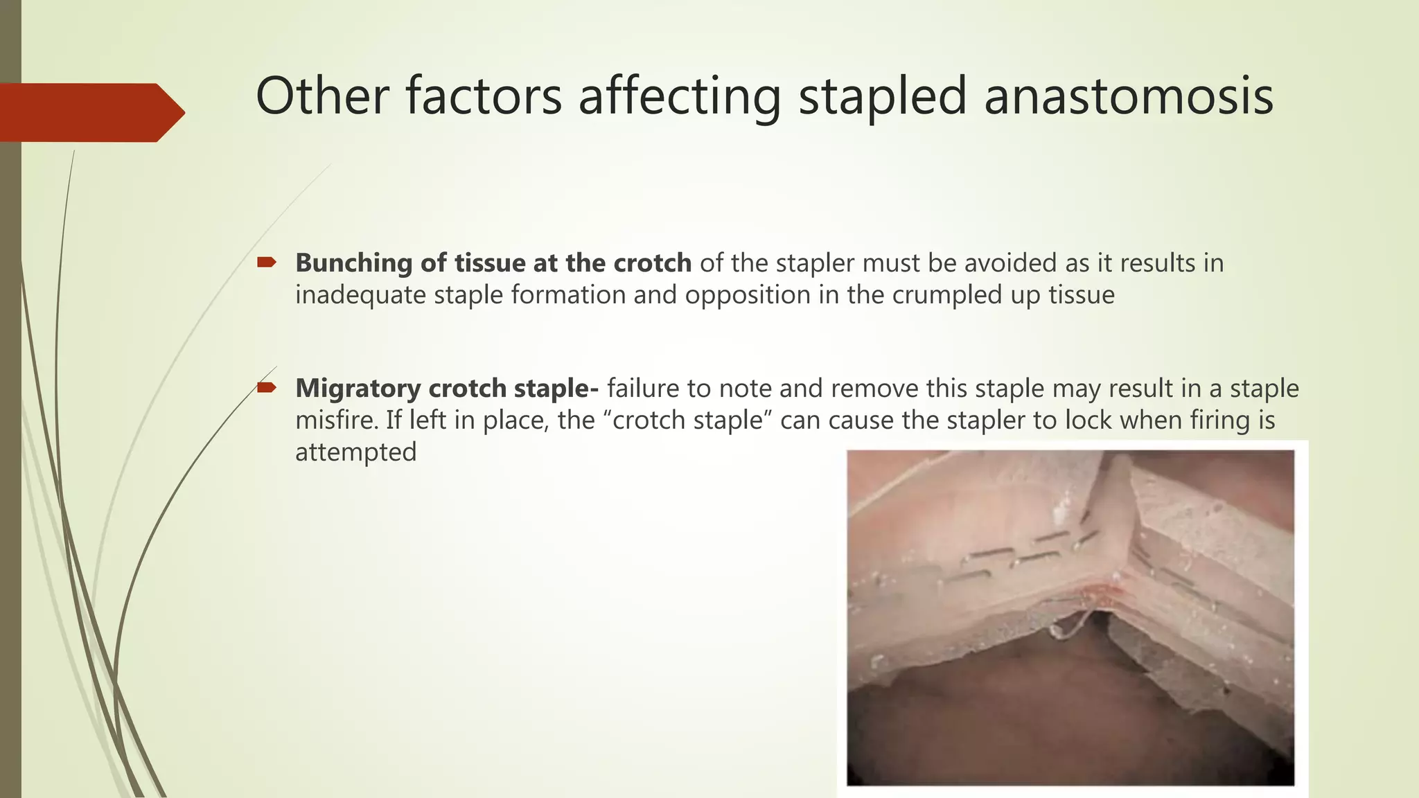 Use of Staplers in surgery | PPTX