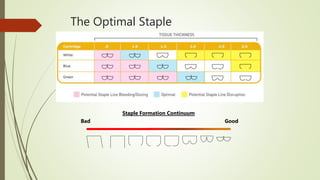 Use of Staplers in surgery | PPTX