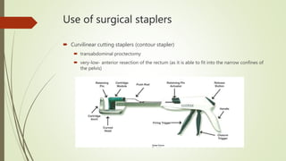 Use of Staplers in surgery | PPTX