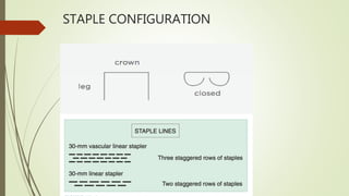 Use of Staplers in surgery | PPTX