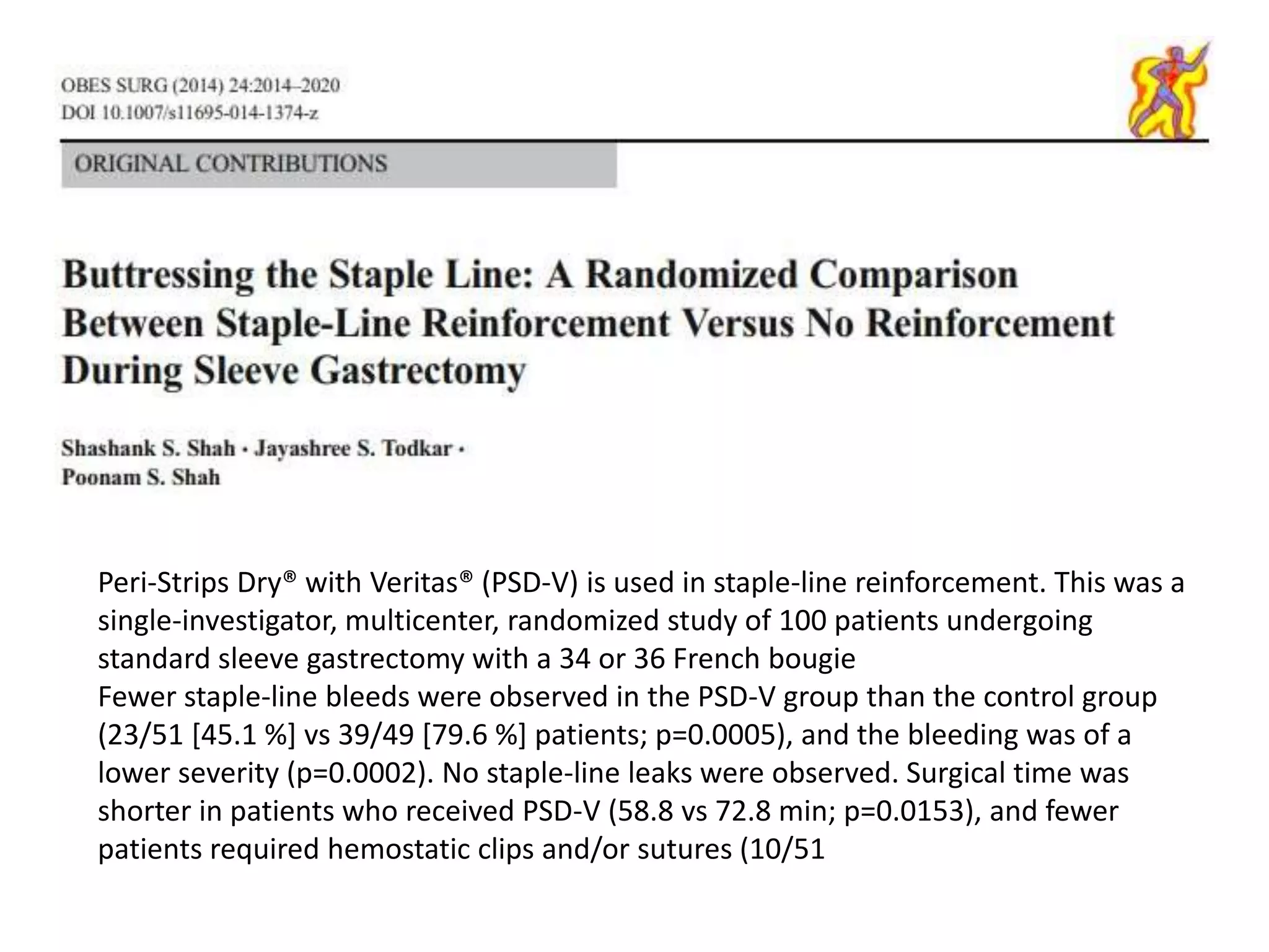 Stapling devices in surgery | PPTX