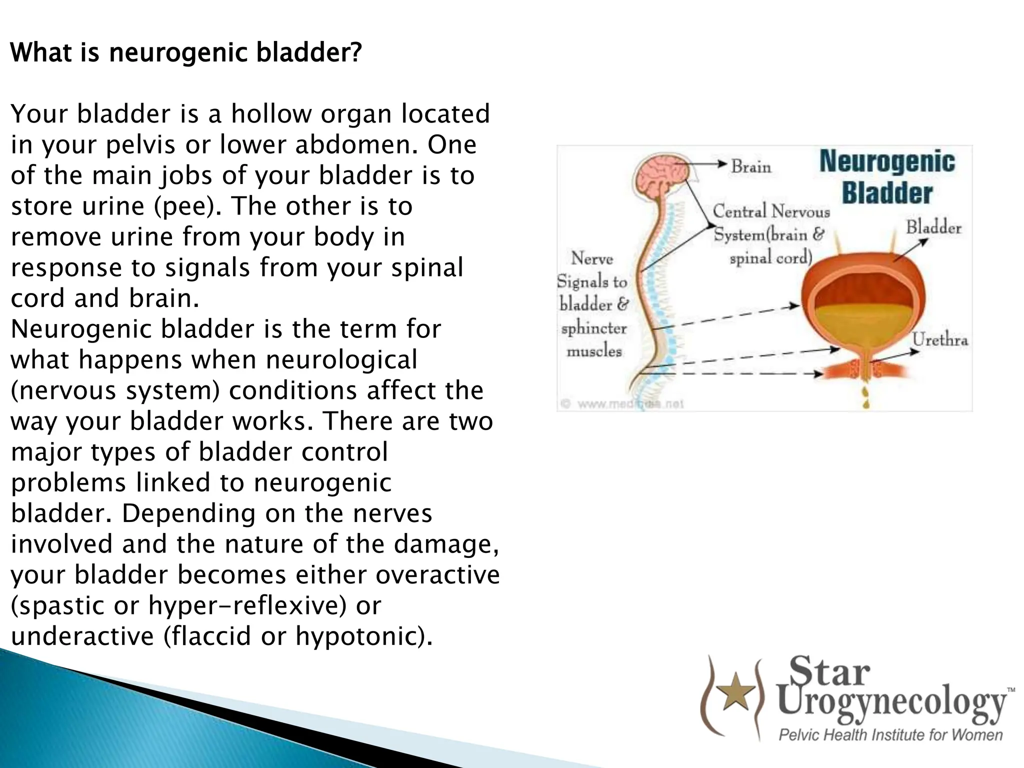 Star Urogynecologist urogynecologist phoenix | PPTX
