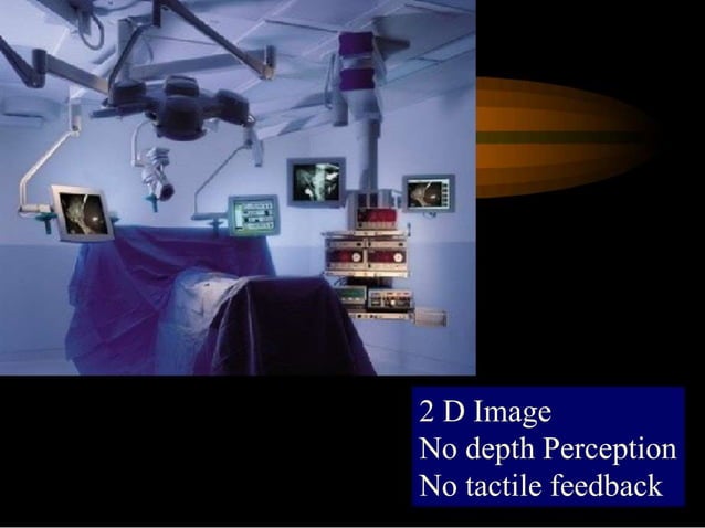 STARR procedure in ODS patients.pptx