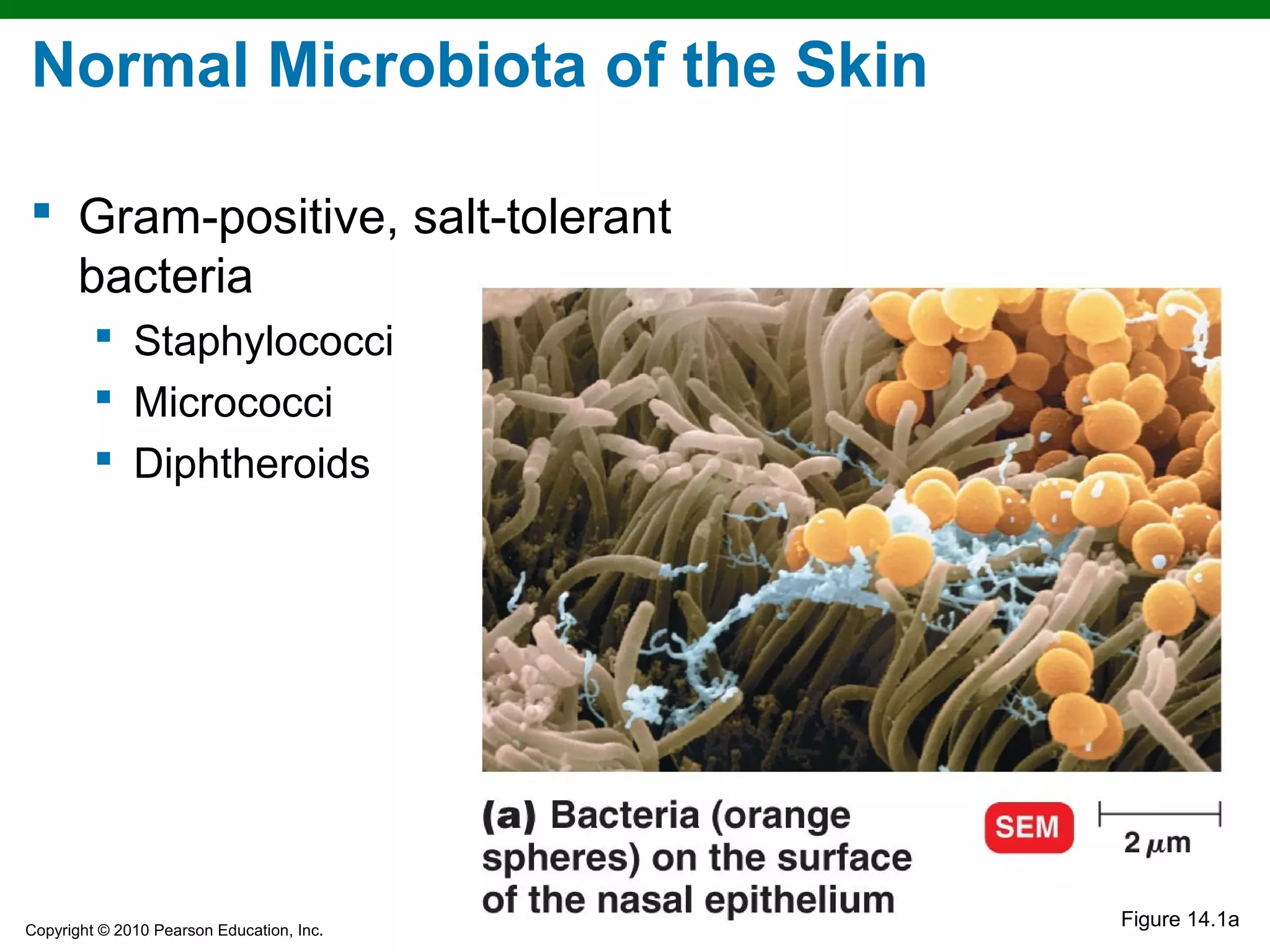 Microbial Diseases of the Skin and Eyes | PPT