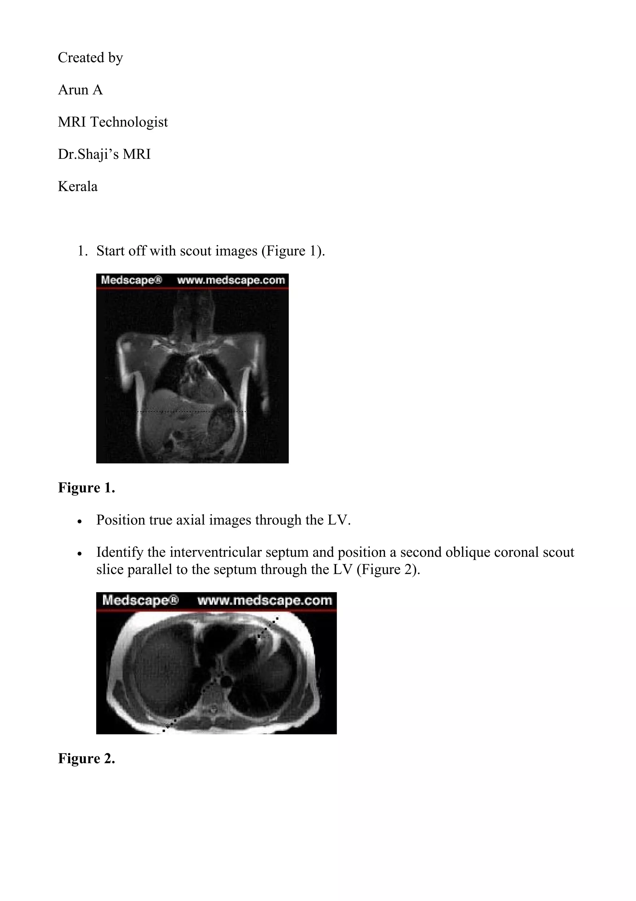 Cardiac MRI | PDF