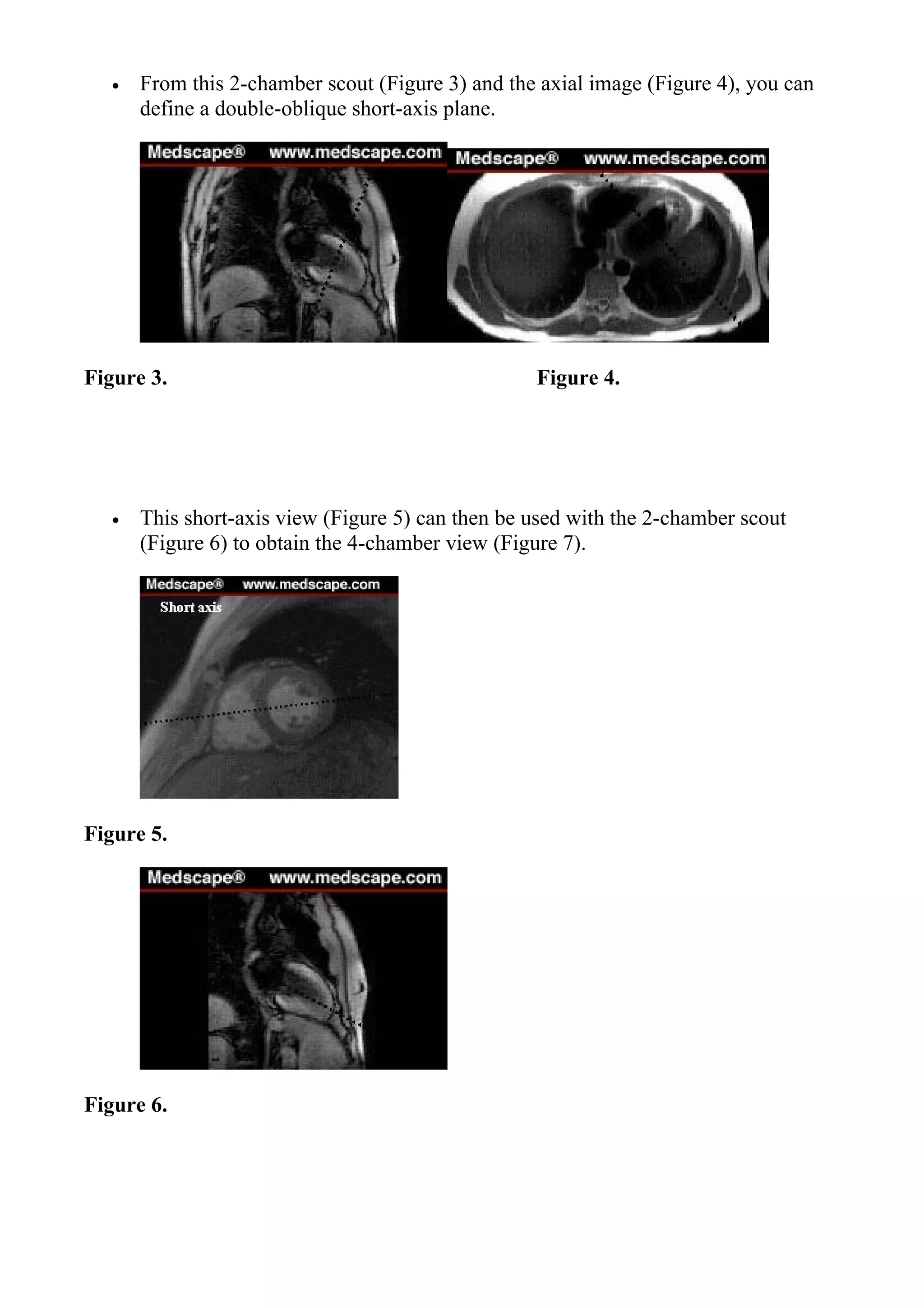 Cardiac MRI | PDF