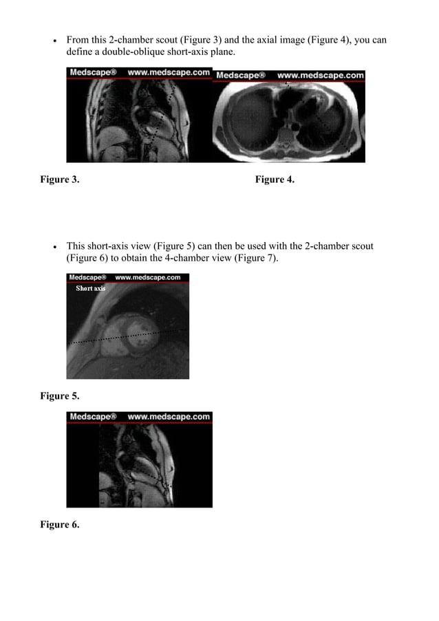 Cardiac MRI | PDF