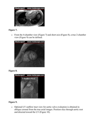 Cardiac MRI | PDF