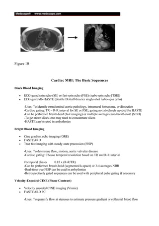 Cardiac MRI | PDF