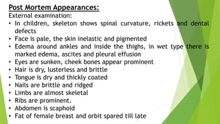 Starvation and its mli | PPTX