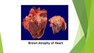 Starvation and its mli | PPTX