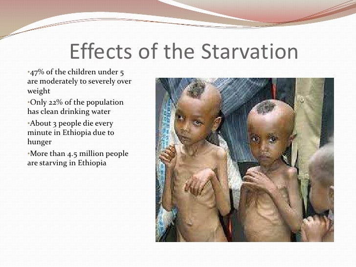 Starvation in ethiopia