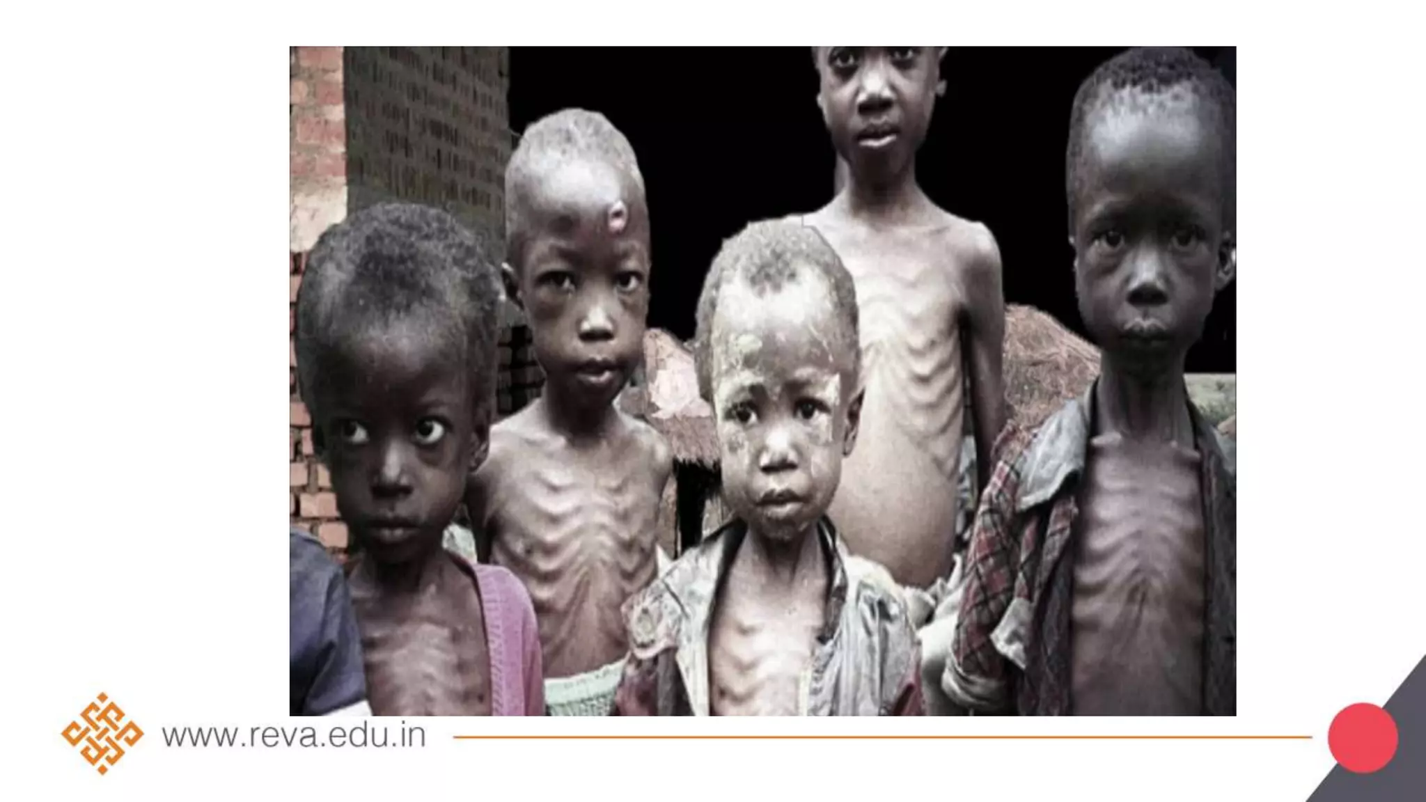 Starvation ppt | PPTX