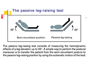 Static and dynamic indices of hemodynamic monitoring | PPT