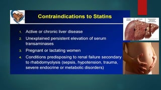 Statin | PPTX