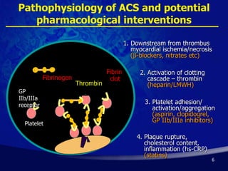 Statins+in+ACS | PPT