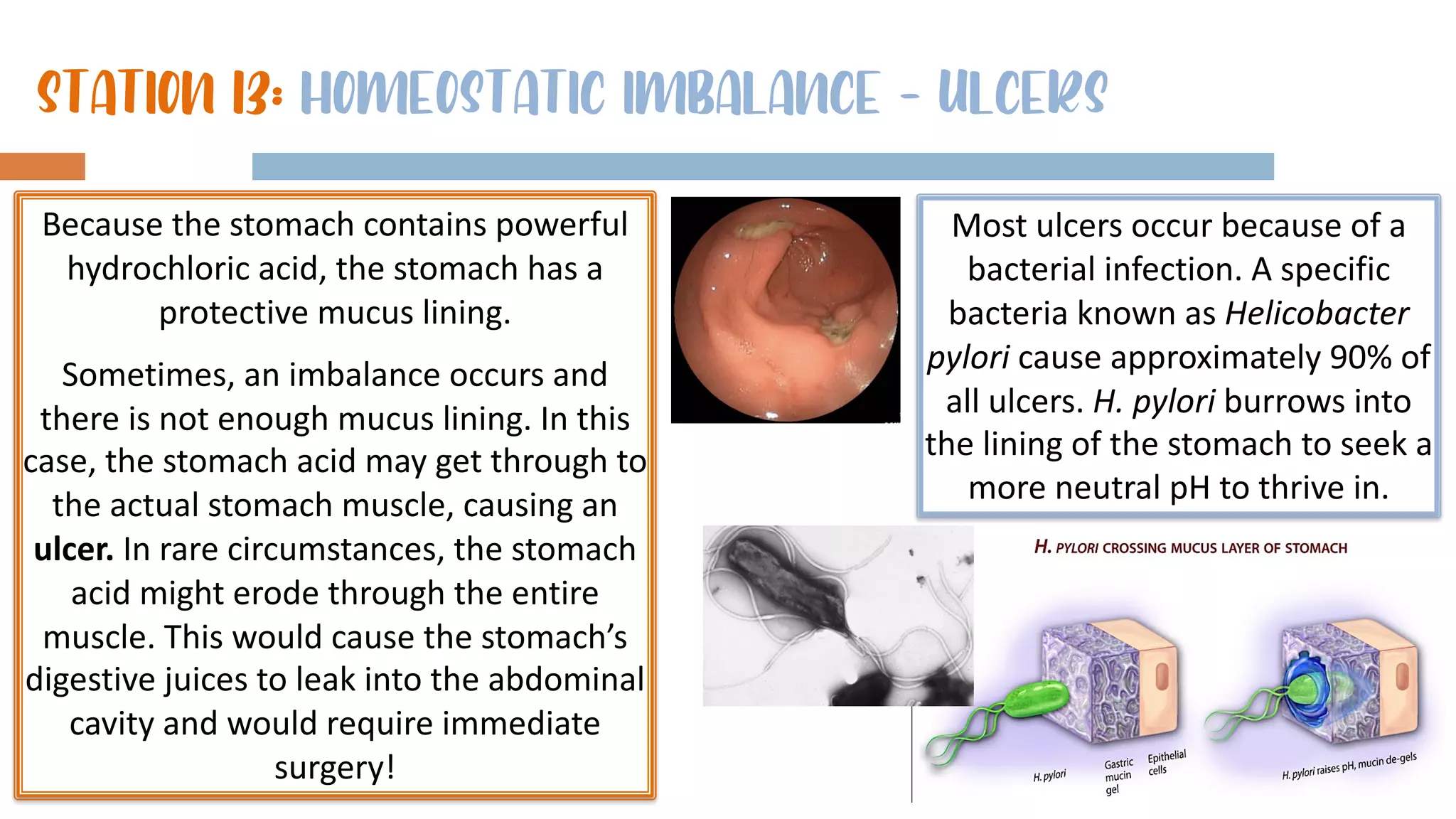 Station 13 digestive system | PDF