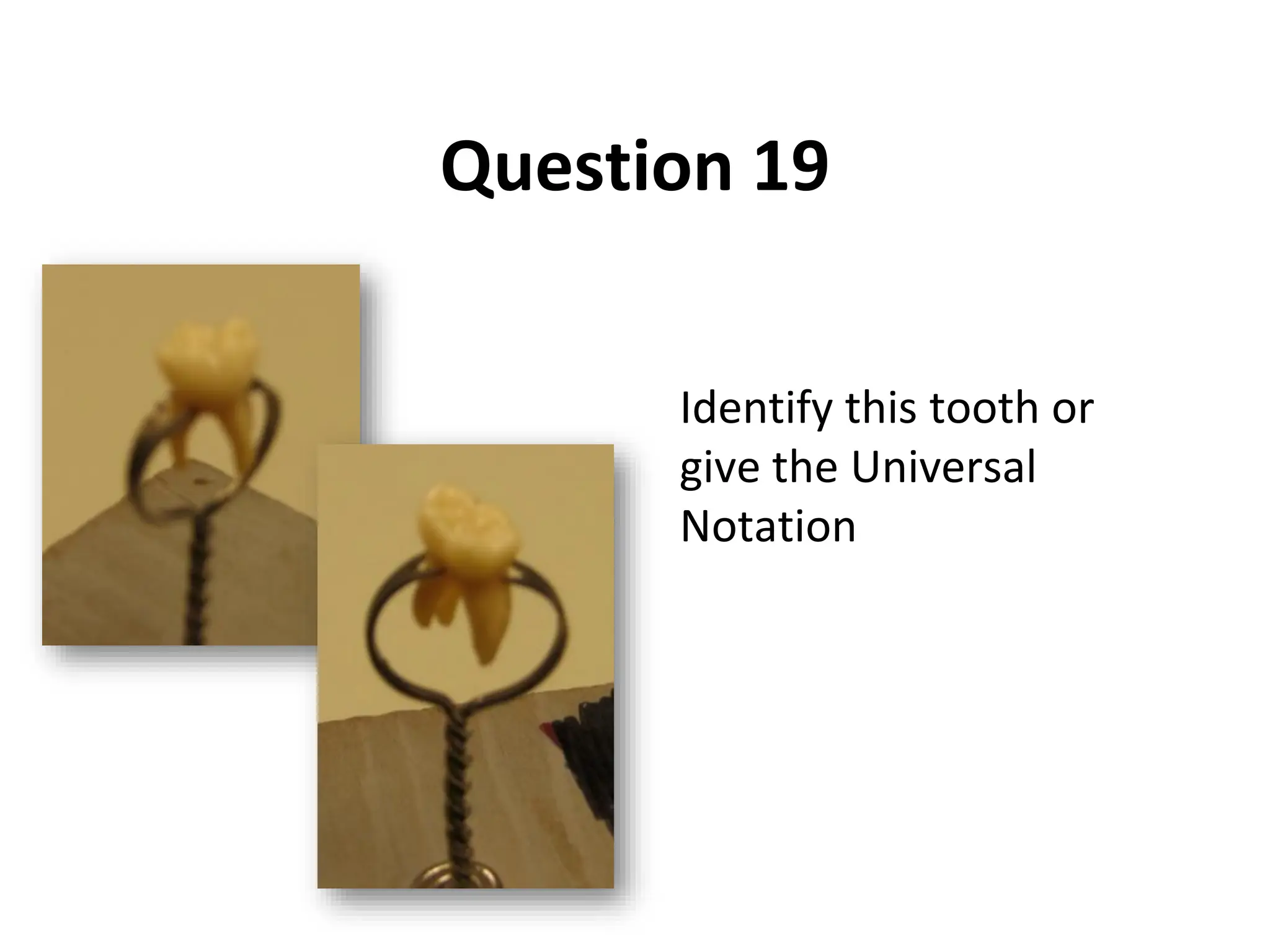 Dental morphology Identification slide exam | PDF