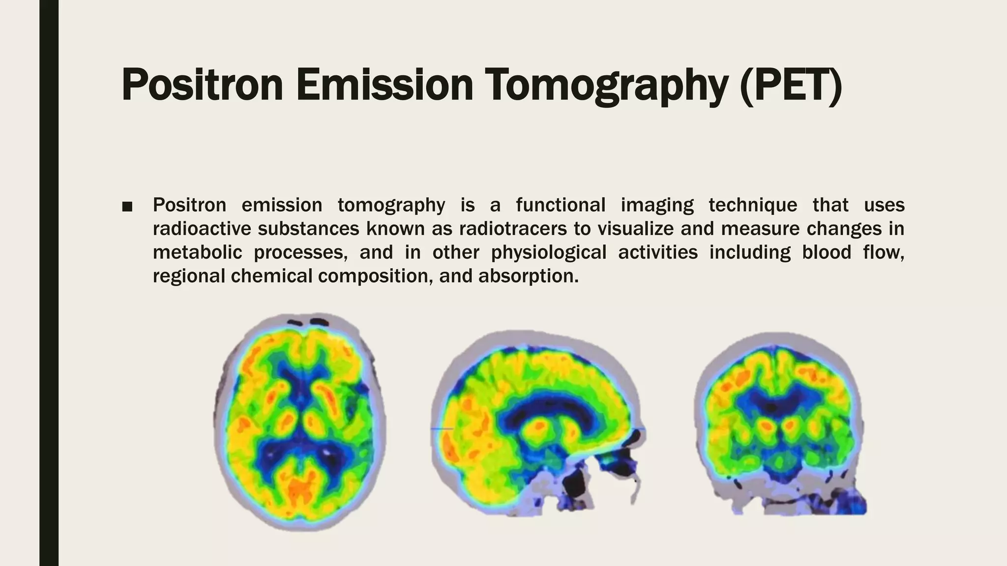 Statistical parametric mapping | PPTX