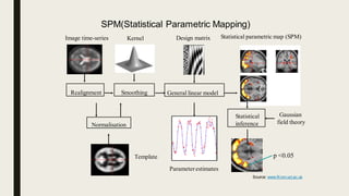 Statistical parametric mapping | PPTX