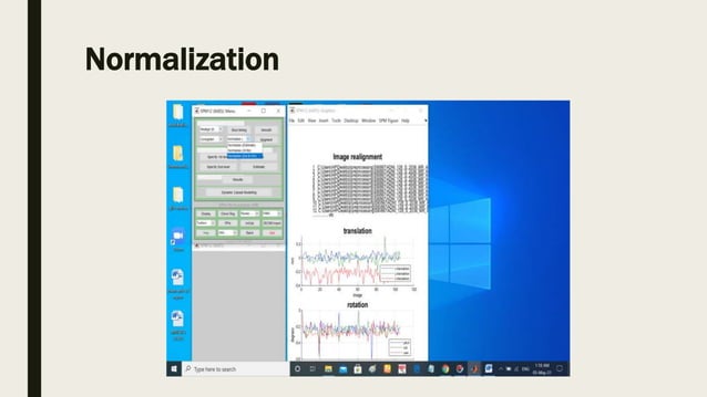 Statistical parametric mapping | PPTX