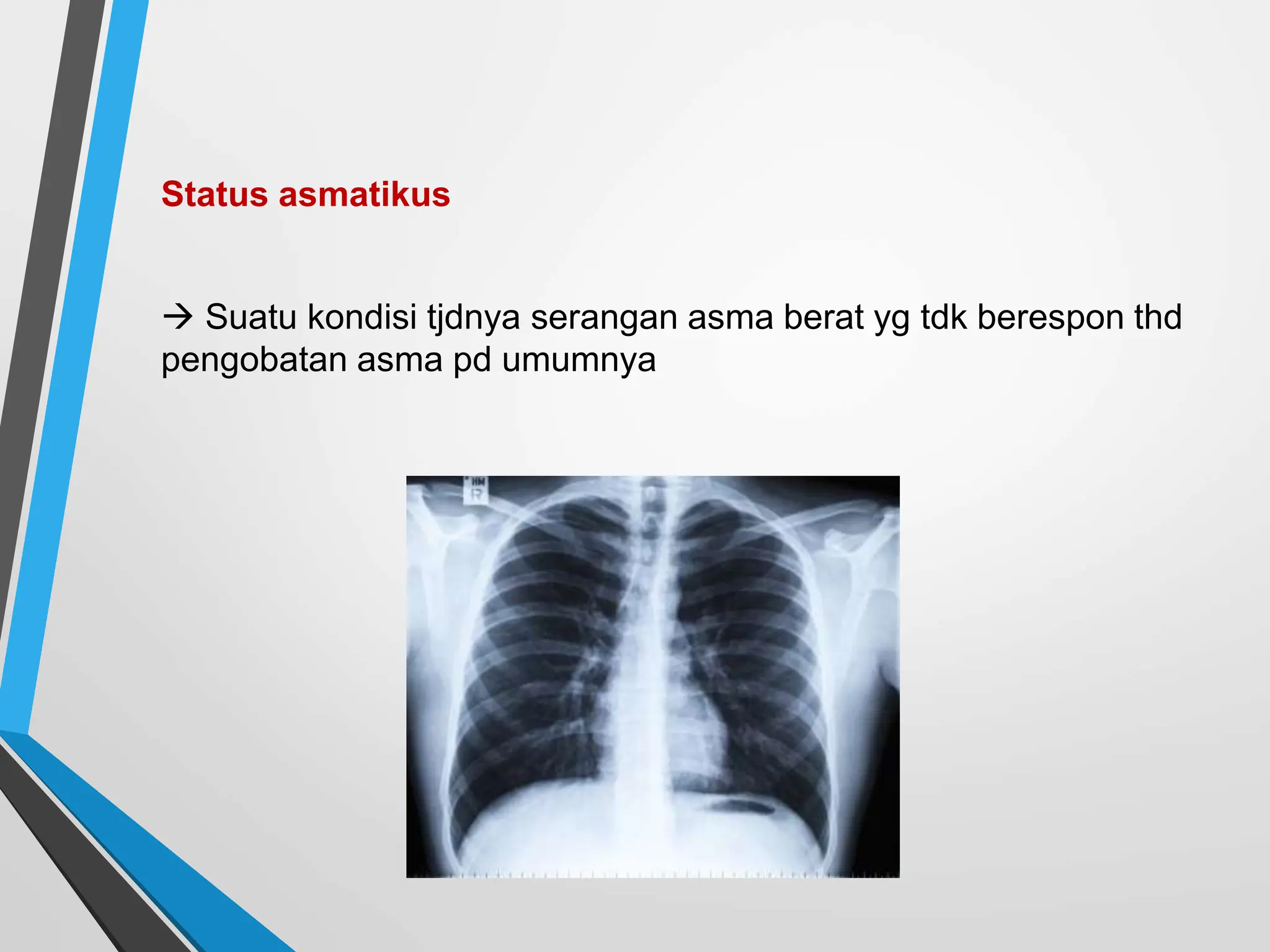Ppt mengenai penyakit STATUS ASMATIKUS.pptx