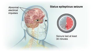 Management of Status Epilepticus | PDF