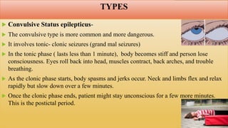 Status epilepticus | PPTX