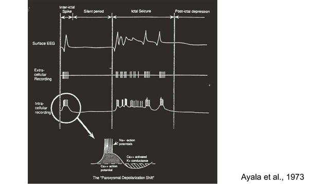 Status epilepticus-Definition and Pathophysiology | PPTX Status epilepticus-Definition and Pathophysiology | PPTX