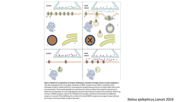 Status epilepticus-Definition and Pathophysiology | PPTX