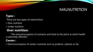 Status of malnutrition in pakistan | PPTX