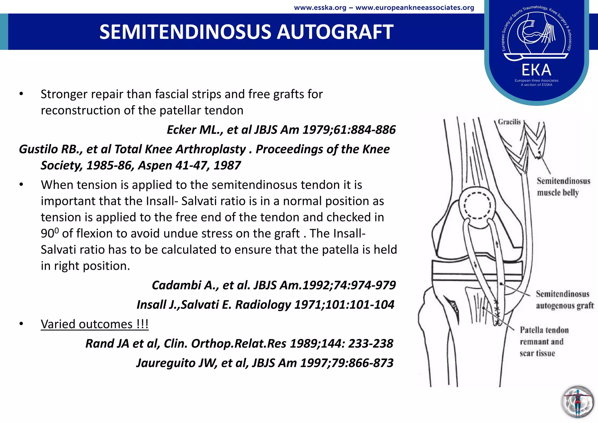 RECONSTRUCTION OF EXTENSOR MECHANISM IN TKA | PDF