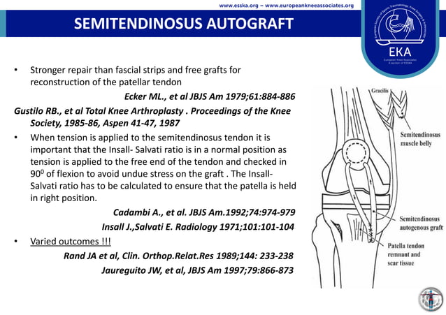 RECONSTRUCTION OF EXTENSOR MECHANISM IN TKA | PDF | Death, Injury, or ...