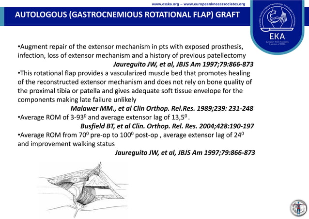 RECONSTRUCTION OF EXTENSOR MECHANISM IN TKA | PDF | Death, Injury, or ...