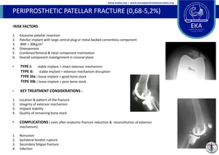 RECONSTRUCTION OF EXTENSOR MECHANISM IN TKA | PDF