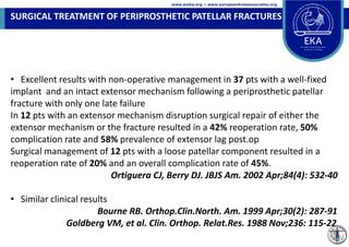 RECONSTRUCTION OF EXTENSOR MECHANISM IN TKA | PDF